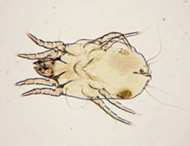 Mites | Allergy Unit - Laboratorios LETI